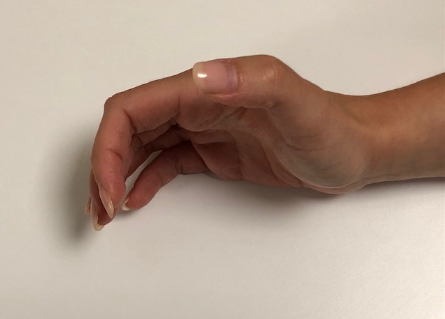 Hand Therapy - Carpometacarpal Joint Osteoarthritis - North Tees and ...