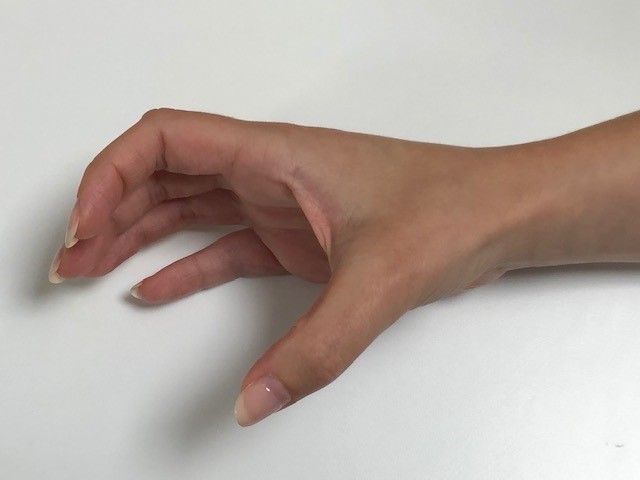 Hand Therapy - Carpometacarpal Joint Osteoarthritis - North Tees and ...