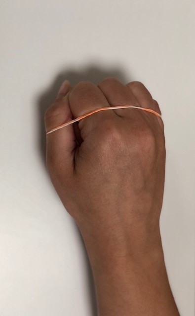 Hand Therapy - Carpometacarpal Joint Osteoarthritis - North Tees and ...
