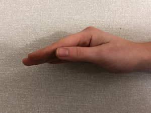 Hand Therapy - Carpometacarpal Joint Osteoarthritis - North Tees and ...