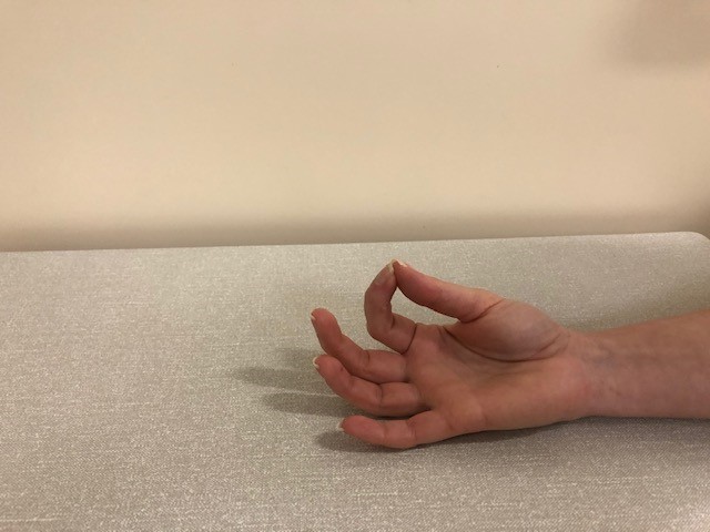 Hand Therapy - Carpometacarpal Joint Osteoarthritis - North Tees and ...