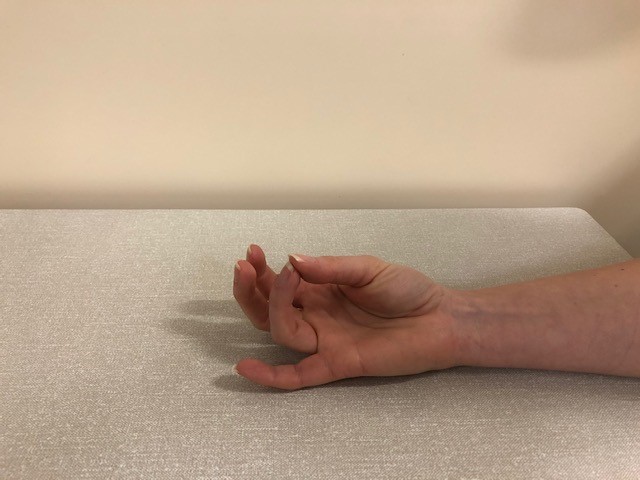 Hand Therapy - Carpometacarpal Joint Osteoarthritis - North Tees and ...
