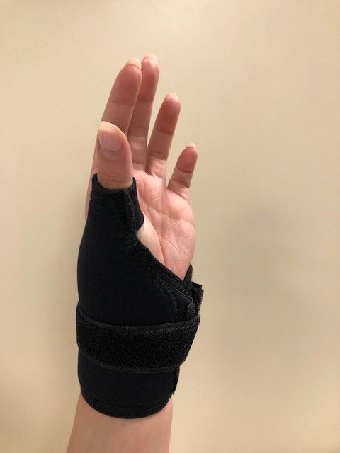 Hand Therapy - Carpometacarpal Joint Osteoarthritis - North Tees and ...