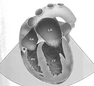 Transoesophageal Echocardiogram (TOE) - North Tees and Hartlepool NHS ...