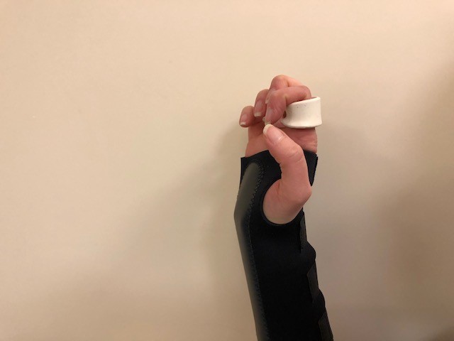 Hand Therapy - Exercises following extensor tendon finger repair. Zone ...