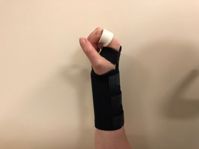 Hand Therapy - Exercises following extensor tendon finger repair. Zone ...