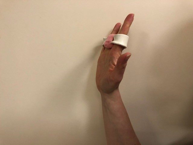 Hand Therapy - Exercises following extensor tendon finger repair. Zone ...