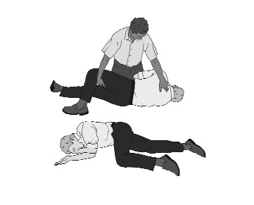 First Seizure Advice - North Tees and Hartlepool NHS Foundation Trust