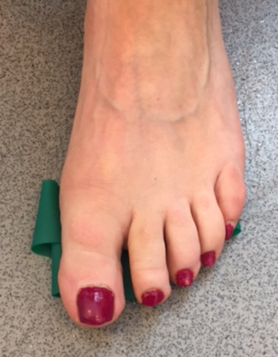 Post-operative Rehabilitation Advice - Department of Podiatric Surgery ...