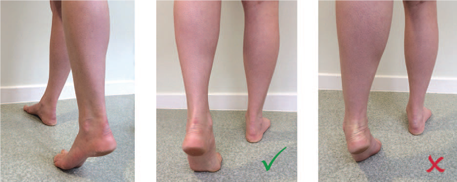 Post-operative Rehabilitation Advice - Department of Podiatric Surgery ...