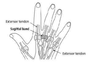 Hand Therapy - Sagittal Band Repair - North Tees and Hartlepool NHS ...