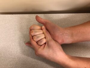 Hand Therapy - Exercises following Volar Plate Injury - North Tees and ...