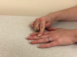 Hand Therapy - Exercises following Volar Plate Injury - North Tees and ...