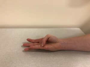 Hand Therapy - Exercises following Extensor Pollicis Longus (EPL ...
