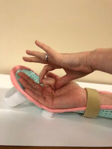 Hand Therapy - Exercises following Flexor Tendon Finger Repair - North ...