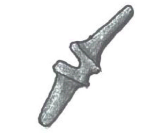 Hand Therapy – Metacarpal Phalangeal Joint (MCPJ) Replacement - North ...