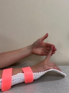 Hand Therapy - Exercises following Metacarpal Phalangeal Joint (MCPJ ...
