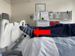 Bed Exercise - North Tees and Hartlepool NHS Foundation Trust