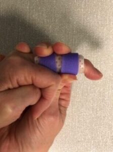 Hand Therapy – Exercises following proximal interphalangeal joint (PIPJ ...