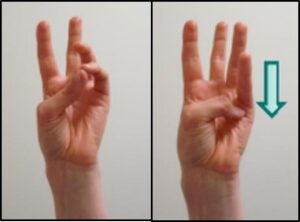 Hand Therapy - Trigger Thumb - North Tees and Hartlepool NHS Foundation ...