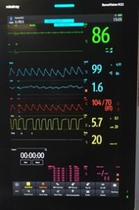 Critical Care Rehabilitation Manual - The Road to Recovery - North Tees ...